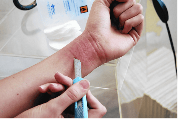 Bệnh tự làm tổn thương mình - triệu chứng và cách điều trị